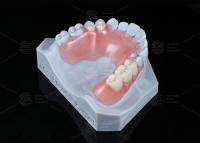 China TCS Flexible Partial Stain Resistant BPA Free Partial Dentures For Natural Look for sale