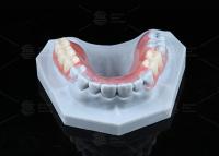 China TCS Flexible Partial Stain Resistant BPA Free Partial Dentures For Natural Look for sale