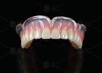 China Vertex Clear And Pink Full Denture Virtually Unbreakable Affordable Partial Dentures for sale