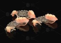 China Vertex Clear  Flexible Partial Virtually Unbreakable Low Allergy Risk Full Partial Denture for sale