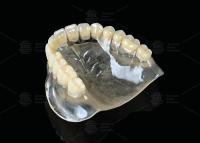 China Heat Curing Vertex Thermosens Dentures For Clear Full Denture Wearers for sale