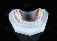 China Lightweight Valplast Flexible Partial With Excellent Retention In Pink And Meharry for sale
