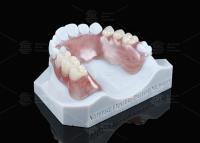 China Lightweight Valplast Flexible Partial With Excellent Retention In Pink And Meharry for sale