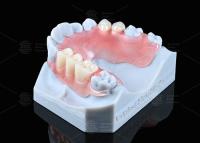 China Natural Looking Valplast Partial Denture Longevity Highly Resistant To Fractures for sale
