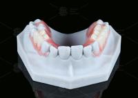 China Natural Looking Valplast Partial Denture Longevity Highly Resistant To Fractures for sale