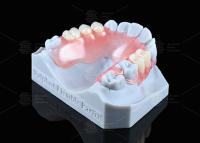 China Natural Looking Valplast Partial Denture Longevity Highly Resistant To Fractures for sale