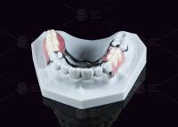 China Removable Metal Acrylic Partial Denture With Clasps For Partial Chewing for sale