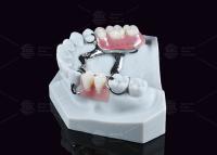 China Removable Metal Acrylic Partial Denture With Clasps For Partial Chewing for sale