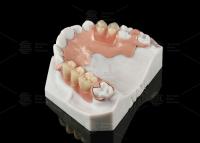 China White And Pink Peek Flexible Acrylic Partial Denture With Excellent Resistance for sale
