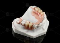 China White And Pink Peek Flexible Acrylic Partial Denture With Excellent Resistance for sale