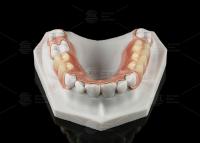 China White And Pink Peek Flexible Acrylic Partial Denture With Excellent Resistance for sale