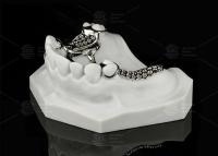 China Repairable Cobalt Chromium Dental Metal Framework Partial Denture for sale