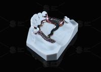 China Sensitive Skin High Strength Titanium Framework Solution 3D Printed for sale