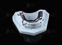 China Sensitive Skin High Strength Titanium Framework Solution 3D Printed for sale