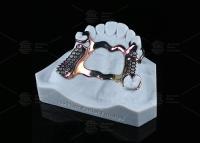 China Sensitive Skin High Strength Titanium Framework Solution 3D Printed for sale