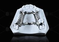 China High Strength 3D Printed Titanium Framework With Clear Clasps For Durable Performance for sale