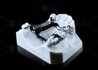 China High Strength 3D Printed Titanium Framework With Clear Clasps For Durable Performance for sale
