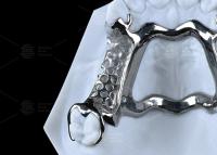 China High Strength 3D Printed Titanium Framework With Clear Clasps For Durable Performance for sale