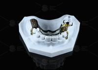 China Corrosion Resistant Printed Titanium Framework Sensitive Skin for sale