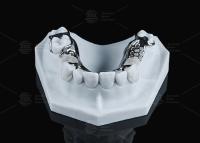 China FDA Vitallium Framework With Tooth Colored Clasps For Natural Esthetics for sale