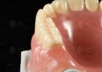 China Lucitone 199 Full Denture Acrylic Teeth Heat Curing Acrylic Complete Denture for sale