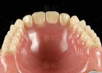 China Lucitone 199 Full Denture Acrylic Teeth Heat Curing Acrylic Complete Denture for sale