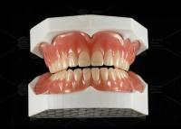 China High Esthetics Removable Full Acrylic Denture Acrylic Complete Denture for sale