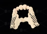 China Milled Peek Framework Customizable Digital Partial Dentures Superior Thin for sale