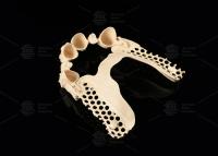 China Milled Peek Framework Customizable Digital Partial Dentures Superior Thin for sale