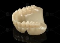 China 3D Printed Dentures Try In Bio Compatible A1/A2/A3 Perfect Fit And Occlusion for sale