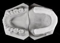 China Durability and Breathability 3D Printed Nylon Occlusal Splint / Night Guard for Active Lifestyles for sale