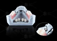 China Titanium Dental Implant Ball Attachments Comfortable Secure Denture Retention for sale
