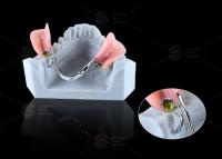 China Titanium Dental Implant Ball Attachments Comfortable Secure Denture Retention for sale