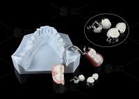 China Adjustable Multi Functional ERA Precision Attachment Removable ERA Attachments For Dentures for sale
