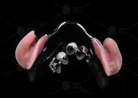 China Adjustable Multi Functional ERA Precision Attachment Removable ERA Attachments For Dentures for sale