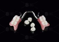China Sleek Precision ERA Dental Attachments For Universal Secure Dental Prosthetics for sale