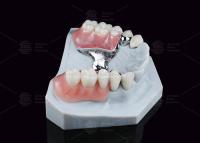 China Dental Prostheses Key Way Attachment Precision Attachment Adjustable Retentive Force for sale