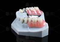 China Silver Key And Keyway Attachment Easy Maintenance Precision Attachment Dental for sale