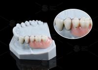 China MK1 Attachment Dental Prosthesis Silver Partial Denture Precision Attachments for sale