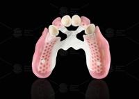 China Biocompatibility Dental Telescope White Inner Zirconia Outer Peek Telescope Dental for sale