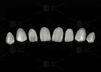 China Natural Pressed EMAX Veneer Strength 16 Shades Emax Teeth Veneers for sale