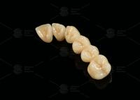 China Strong Aesthetic Porcelain Fused To Zirconia For Natural Looking Restorations for sale
