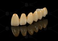 China Strong Aesthetic Porcelain Fused To Zirconia For Natural Looking Restorations for sale