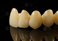 China Strong Aesthetic Porcelain Fused To Zirconia For Natural Looking Restorations for sale