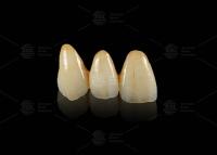 China Durable Hypoallergenic EMAX Bridge Extreme Esthetics Emax Dental Bridge for sale
