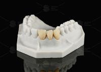 China Durable Hypoallergenic EMAX Bridge Extreme Esthetics Emax Dental Bridge for sale