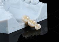 China Translucency White Full Contour Zirconia Crown FCZ Monolithic Zirconia Crown Easy Milling for sale
