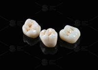 China Natural Full Contour Zirconia Crown Precise Fit Full Contour Dental Lab for sale