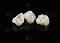 China Natural Full Contour Zirconia Crown Precise Fit Full Contour Dental Lab for sale