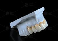 China High Translucency Full Contour Zirconia Bridge Chipping Resistance Natural Esthetics for sale
